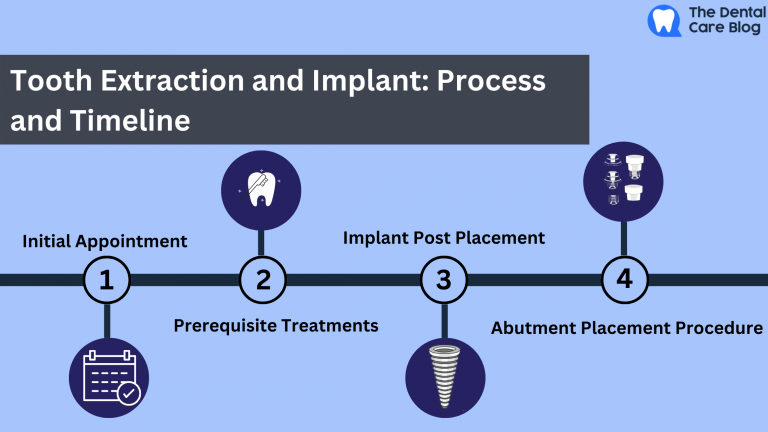 Tooth Extraction and Implant : Timeline and Aftercare